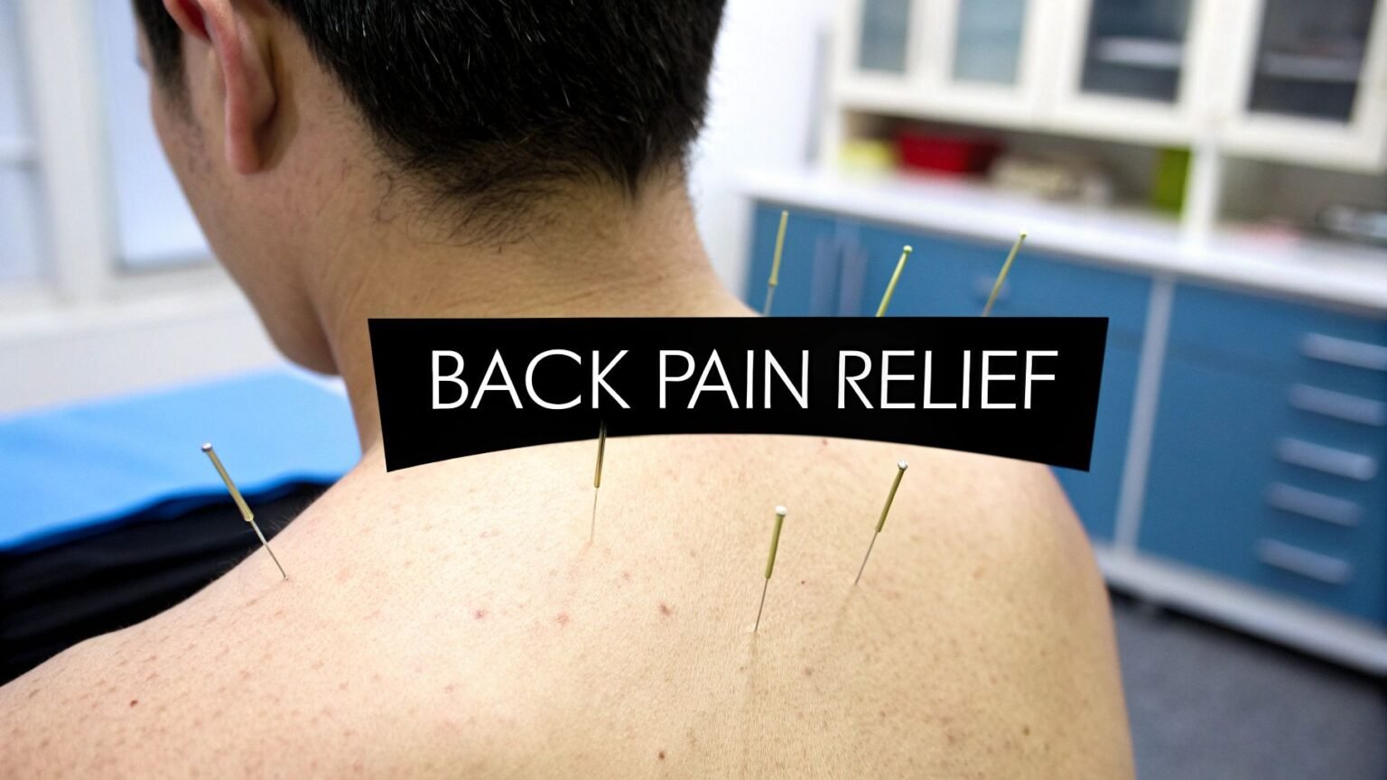 7 Key Acupuncture Points for Back Pain in 2025 - Eric Tsai Acupuncture ...